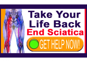 Left Side Sciatica - Sciatica