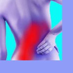 My Sciatica Story - Sciatica