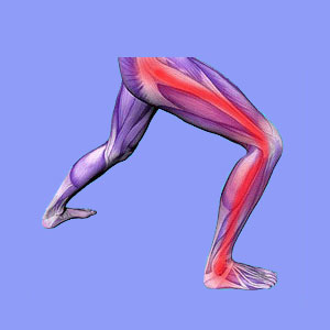 Sciatica from Flat Feet - Sciatica