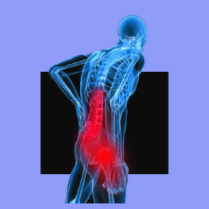 Sciatica Hip Pain - Sciatica
