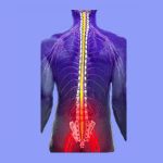 Sciatica Incontinence Sciatica