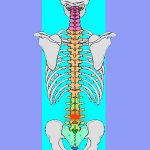 Sciatica L4 - Sciatica