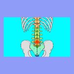 Sciatica L5 - Sciatica