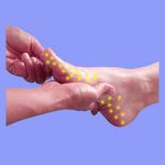 Tingling Feet - Sciatica